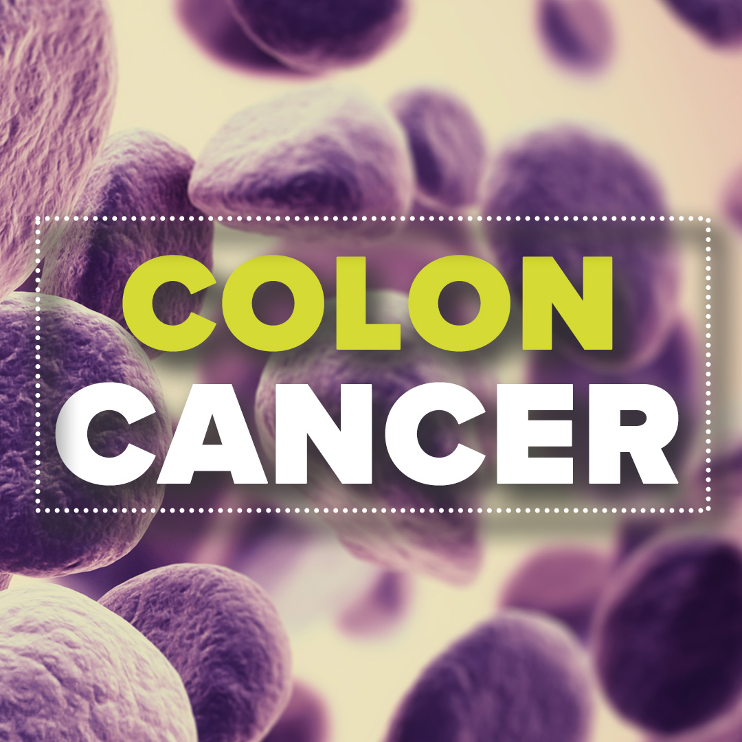 Colon Cancer: Symptoms, Causes, and Treatments - Atrantil