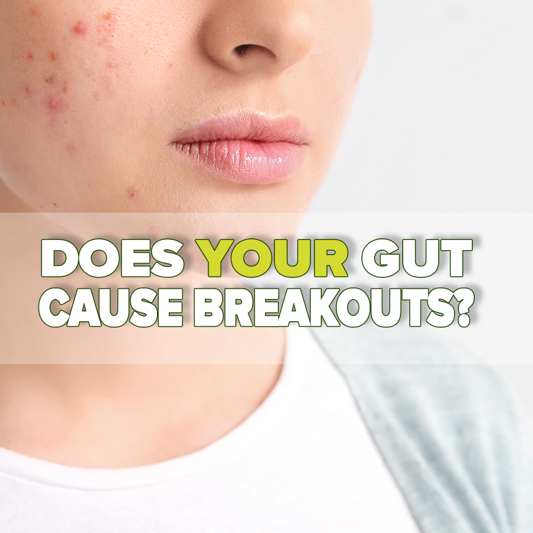 Does Your Gut Cause Breakouts? - Atrantil